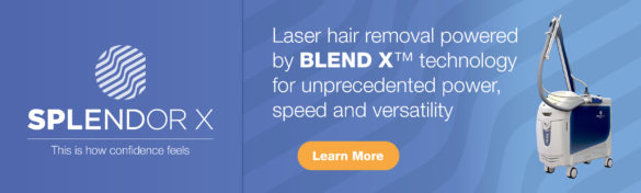SPLENDOR X Laser Hair Removal Workstation Features | Lumenis