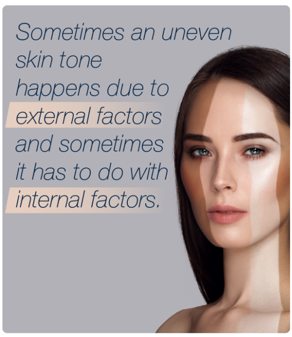 What is Uneven Skin Tone, Causes & Treatments | Lumenis