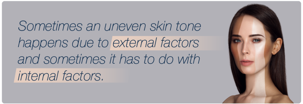 What is Uneven Skin Tone, Causes & Treatments | Lumenis