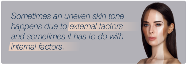 What is Uneven Skin Tone, Causes & Treatments | Lumenis